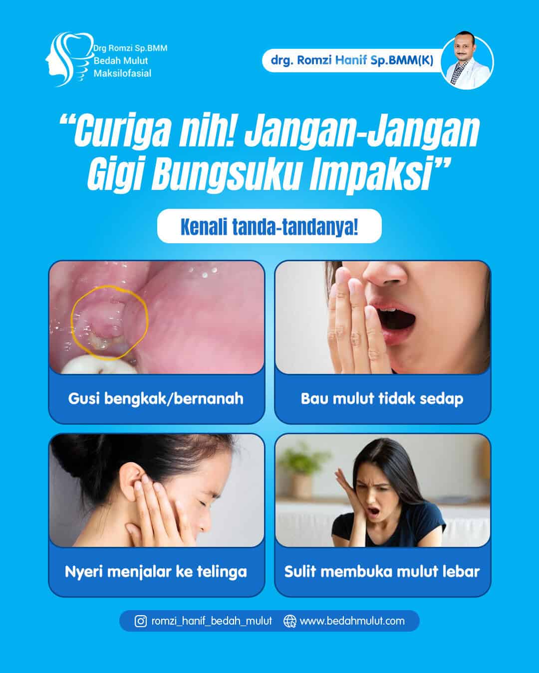 Curiga Gigi Bungsu Impaksi? Jangan Anggap Remeh Rasa Sakit di Belakang Rahang! - Bedah Mulut Drg ...
