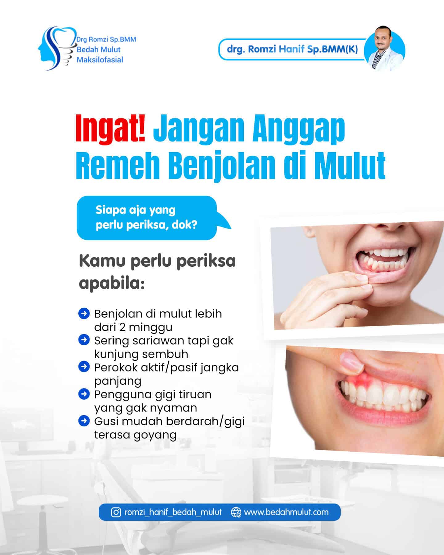 Jangan Anggap Remeh Benjolan di Mulut! Bisa Jadi Gejala Awal Masalah ...