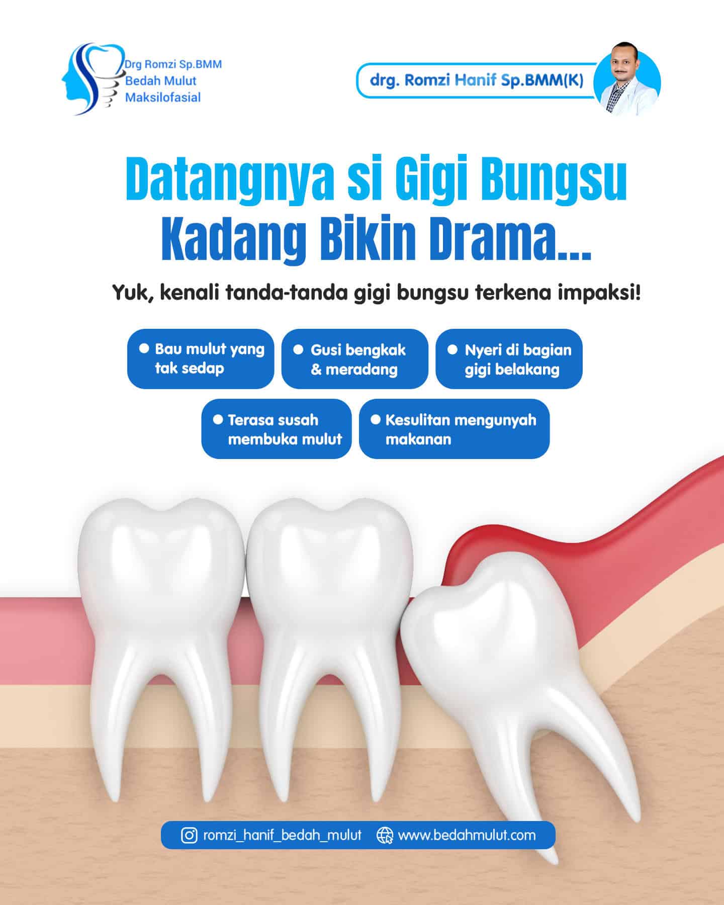 Cabut Gigi Bungsu di Purwokerto & Cilacap – Aman, Cepat, dan Tanpa Drama! - Bedah Mulut Drg ...