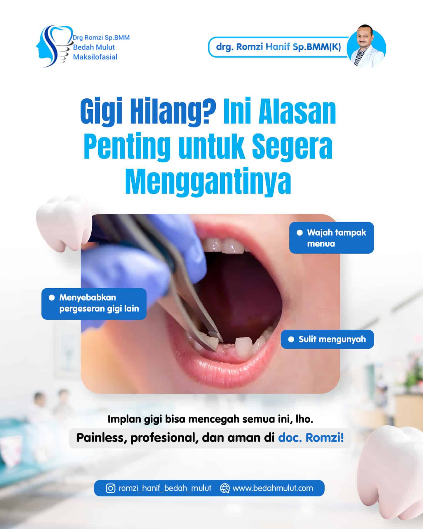Gigi Hilang? Ini Alasan Penting untuk Segera Menggantinya - Bedah Mulut Drg Romzi Hanif Sp.BMM (K)